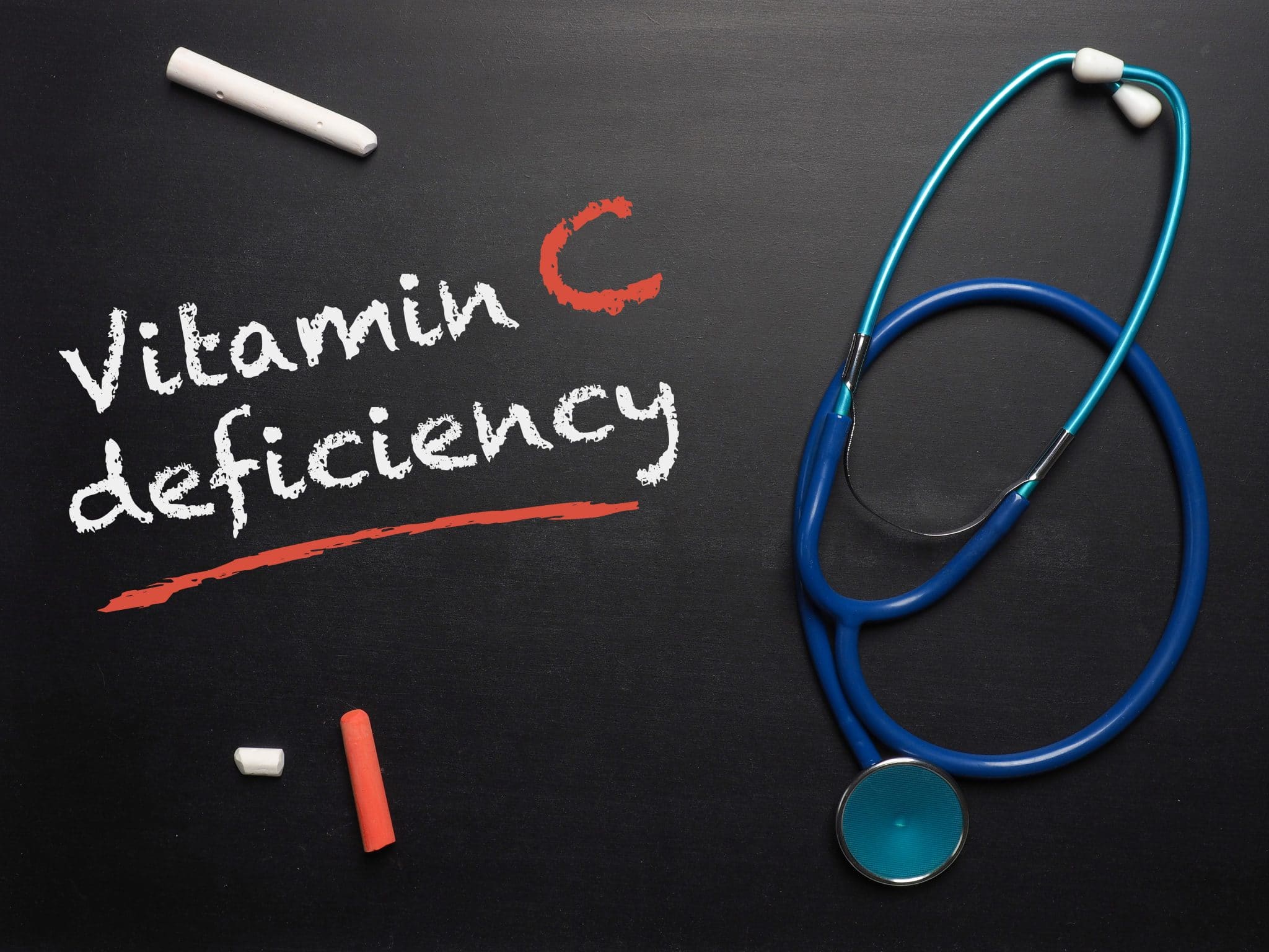 Vitamin C Deficiency - 15 Signs and Symptoms | Orzax
